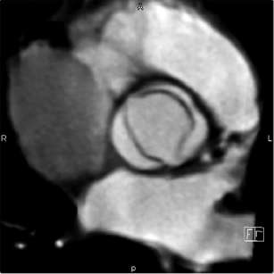 Cardiology secrets: Cardiac CT Angiography. Definition. Diagnostic ...