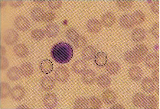 Hemo-Citologia: Como iniciar a análise morfológica