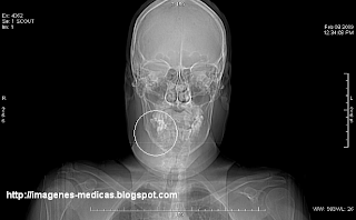 Sobre técnicas de imágenes médicas (Blog STIM): marzo 2009