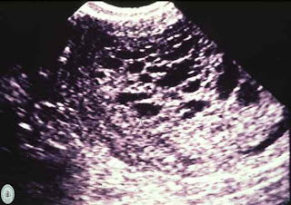 Unidas por un buen embarazo.