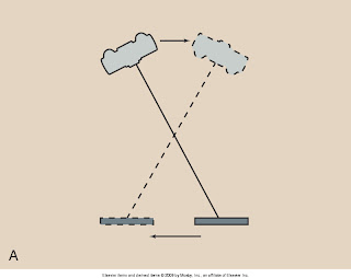 Radiology Technology: Linear Tomography