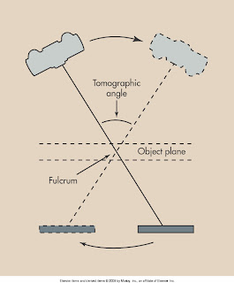 Radiology Technology: Linear Tomography