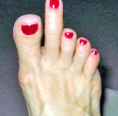 What do your toes look like? - Off-Topic Discussion - GameSpot