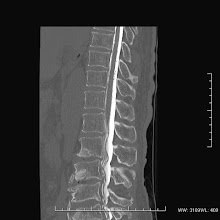 SALLE PRESTIGE II GE