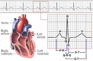 livre medical: ECG : indications et interprétations