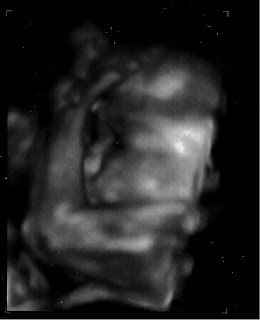 Adventures of the Nevitt Boys...