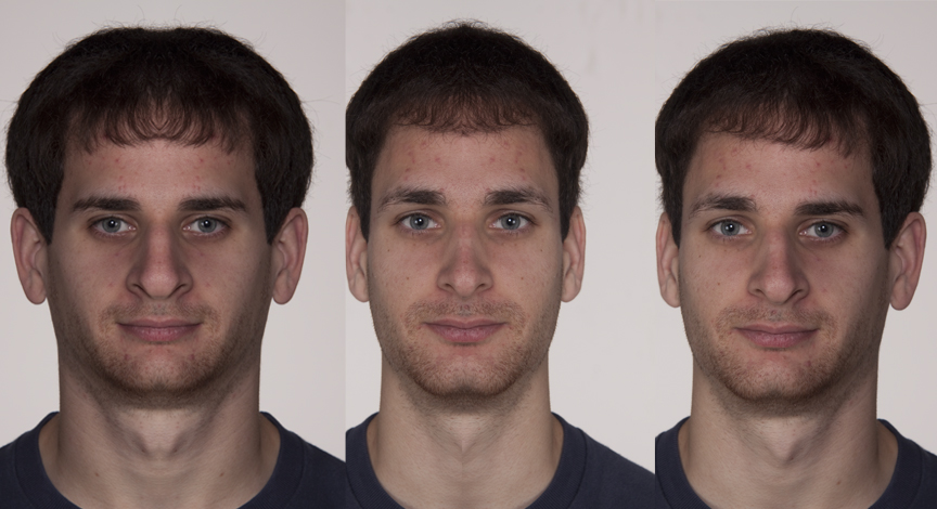 John Couch Photography: Facial Anomaly Corrections