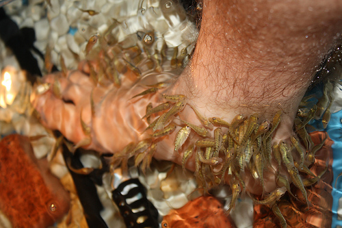 Garra Rufa Fish Therapy ~ Healthy Medicine