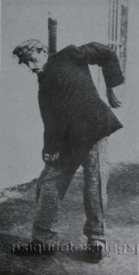 Imágenes de la psiquiatría: 162. La Catatonia. 5) En algunos atlas de ...