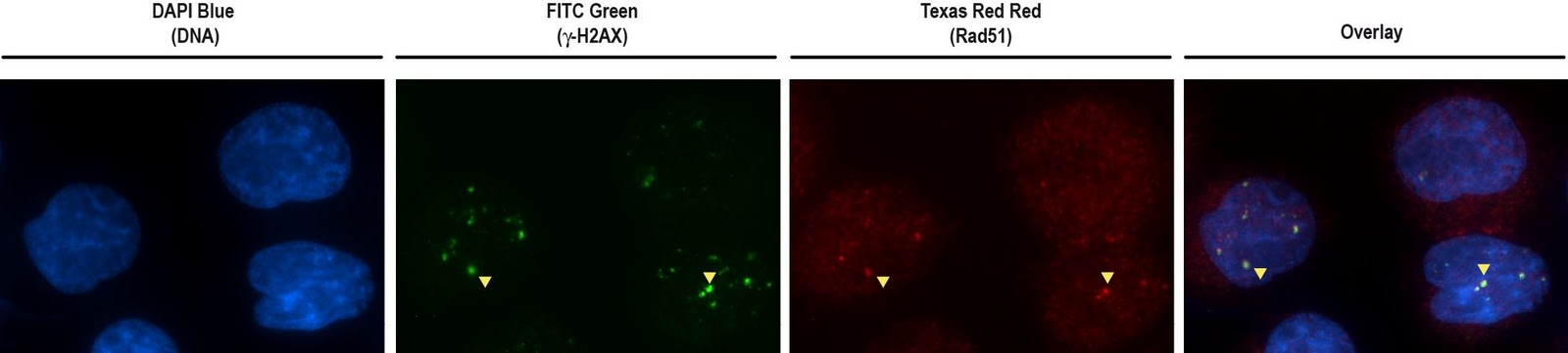 BioFreaks Biochemistry Blog (v.Beta): GGS LIVE - Immunofluorescence