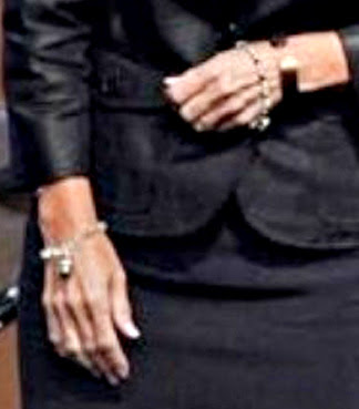 arquazuarma: bony hands