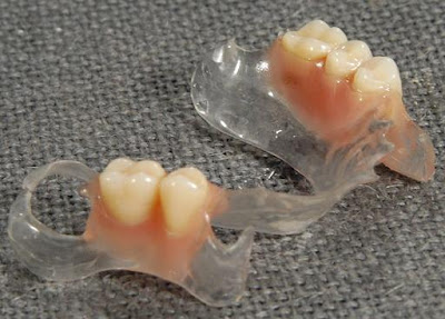 PROTESIS DENTAL: protesis flexible