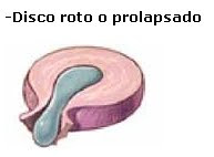 Ingresantes Rx 2009: Historial Clinico