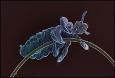 Puntuali arrivano i pidocchi nelle scuole: che fare