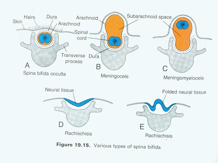 A Repository for Bottled Monsters: Exciting Intern Project at HDAC