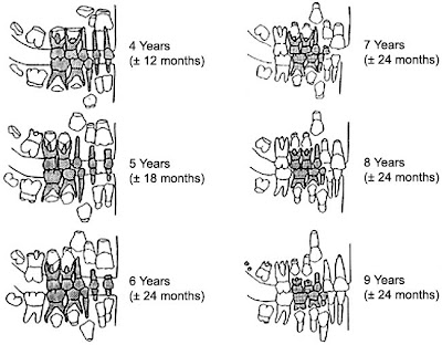 Flesh and Bones: VISUAL AID: AGE ESTIMATION FROM TEETH