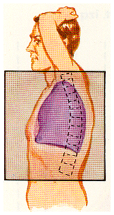 Tecnicas Radiologicas De Torax: Análisis del tórax Proyección lateral