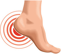 Carolina Foot & Ankle Specialists Heel Pain Center: Recovery after the ...