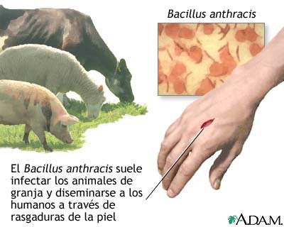 Salud-Vida y Belleza: ¿QUE ES EL ANTRAX?-SALUD-VIDA Y BELLEZA