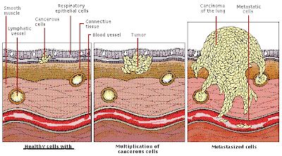 HOW CANCER DEVELOPS | PSHYCOPYMEDIA