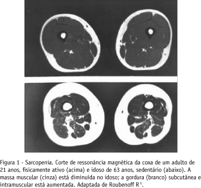 Fisioterapia Quintana: A DIMINUIÇÃO DA MASSA MUSCULAR COM A IDADE