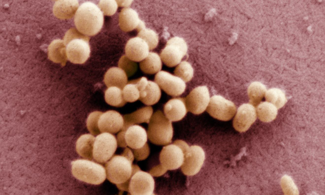 CellNEWS: Artificial Life: First Self-replicating Synthetic Bacterial ...