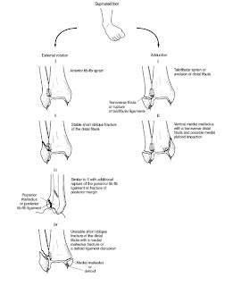 Lauge Hansen Classification - vufasr