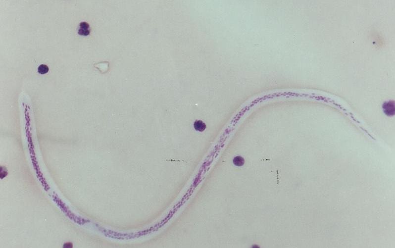 ParasitoBlog: Wuchereria bancrofti