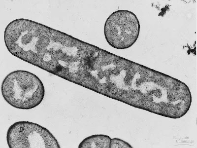 The Data of Microbiology: Bacillus polymyxa(Gram-positive)