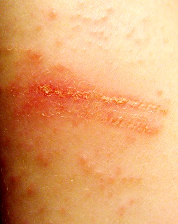 Skin care - Causes of skin sensitivity | the dynamic natural skin care