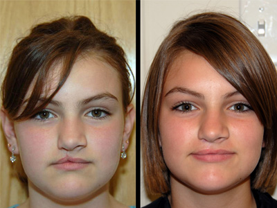 Medical Treatment: Association of Plastic Surgery With Cleft Palate and Lip