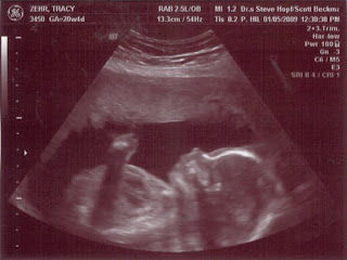 Zehr Family Blog: 5 Month Ultrasound