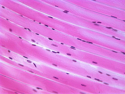 Histology Slides: Skeletal Muscle