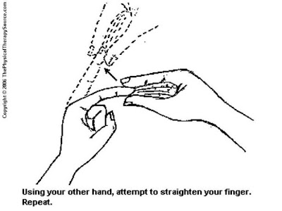 Hand Exercises from ThePhysicalTherapySource.com: Hand - Finger ...