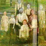 weird diseases: Blue Skin Disorder: the blue people