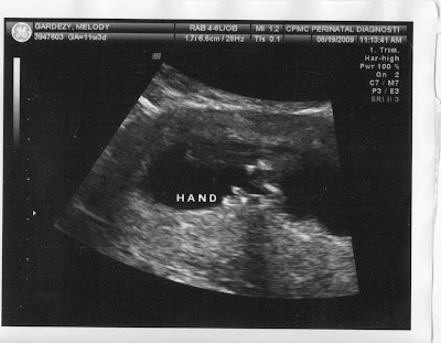 gardezy fam: Gardezy Baby 11 weeks!