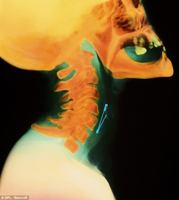 WEIRD NEWS: World's Most weirdest X-rays