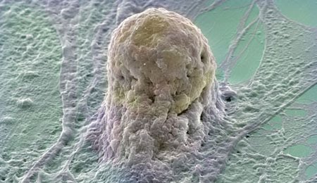 Biblioteca "Dorotea Barnés": Se aprueba el primer transplante animal-humano