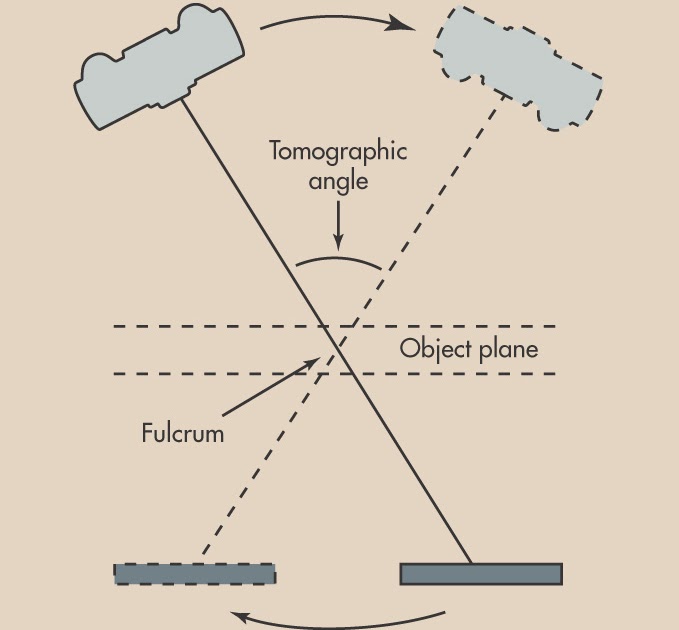 ECC Radiology Spot: Linear Tomography