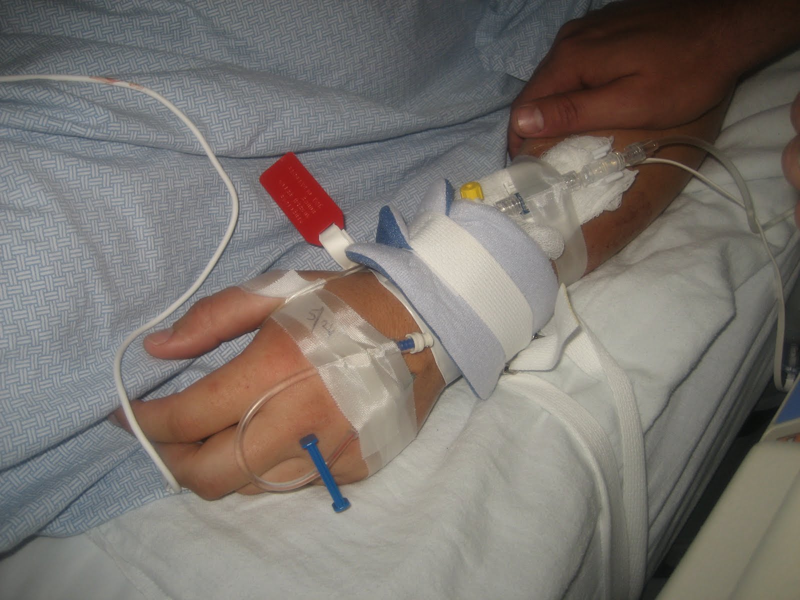 The Dodge Family: Joe's Open Heart Surgery