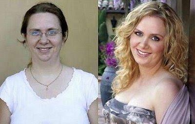 The beautiful results of Plastic Surgery...