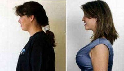 The beautiful results of Plastic Surgery...