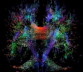 Diffusion Tensor Imaging 101 | Diffusion Imaging; Introduction ...