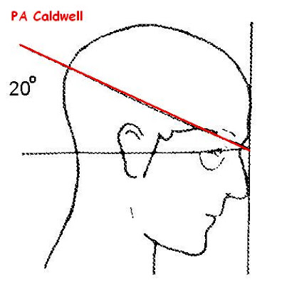 Mountain Imaging: Skull Positioning