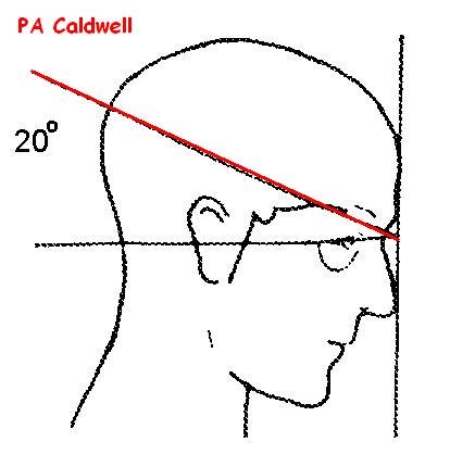 Mountain Imaging: Skull Positioning