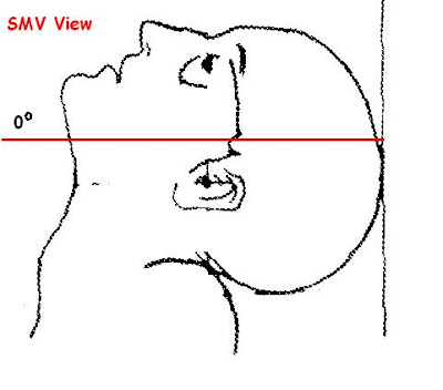 Mountain Imaging: Skull Positioning