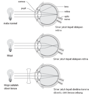 Alat-alat Optik: Mata (Fisika) - Semoga Bermanfaat