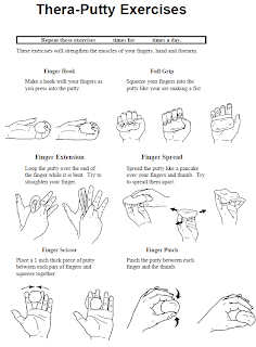 Stroke Wise: Hand exercises