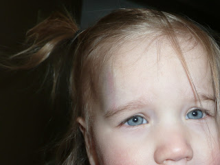 Multiples Mania: Goose Egg