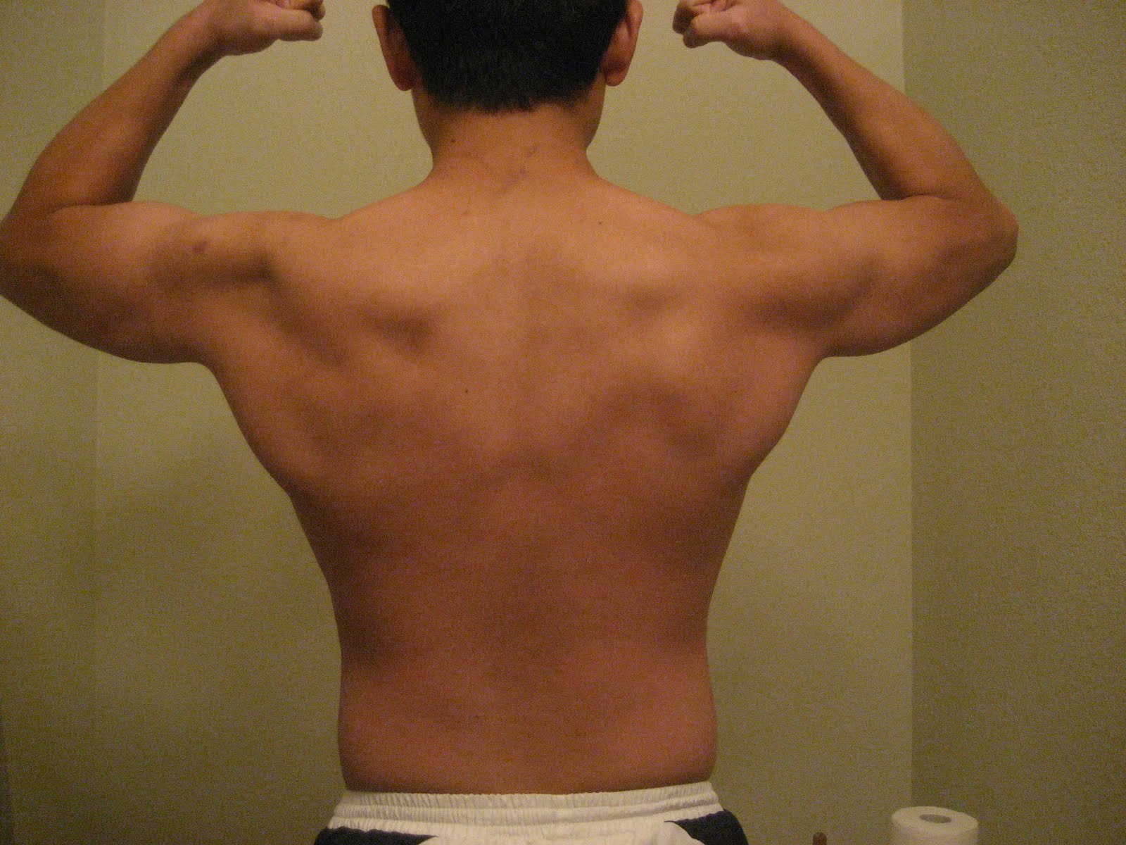 Heal Nerve and Muscular Atrophy: Healing Nerve and Muscular Atrophy ...